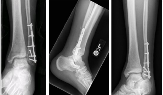 Rxharun |.....a global war against illness!!!