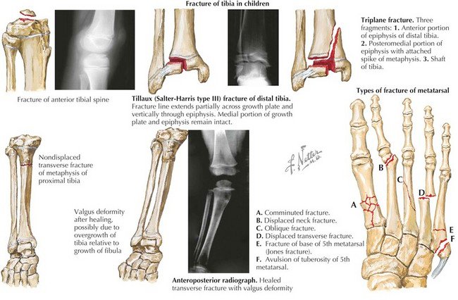 Rxharun |.....a global war against illness!!!