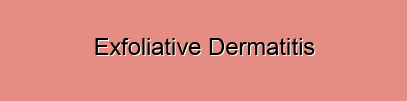 Exfoliative Dermatitis – RxHarun