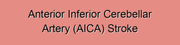Anterior Inferior Cerebellar Artery (AICA) Stroke
