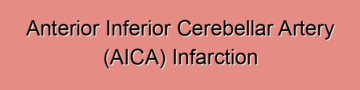 Anterior Inferior Cerebellar Artery (AICA) Infarction