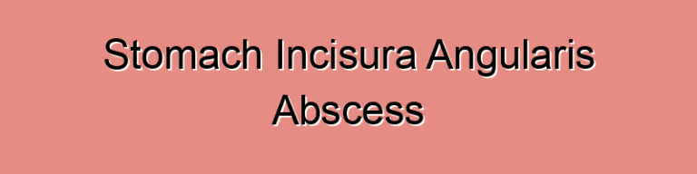 Rxharun |.....a global war against illness!!!